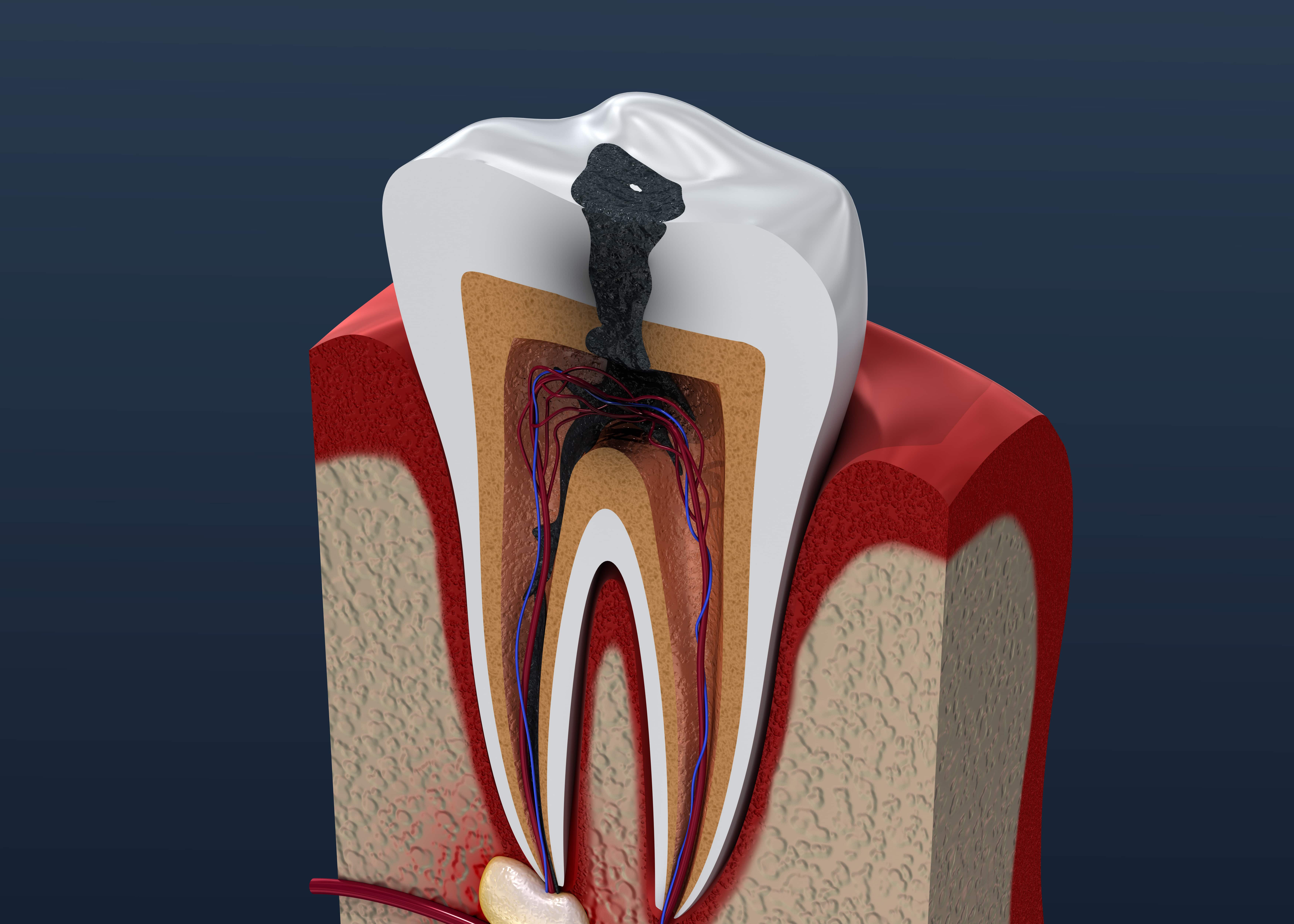 Livonia Explains How To Help Keep Your Smile Cavity-Free | Livonia, MI