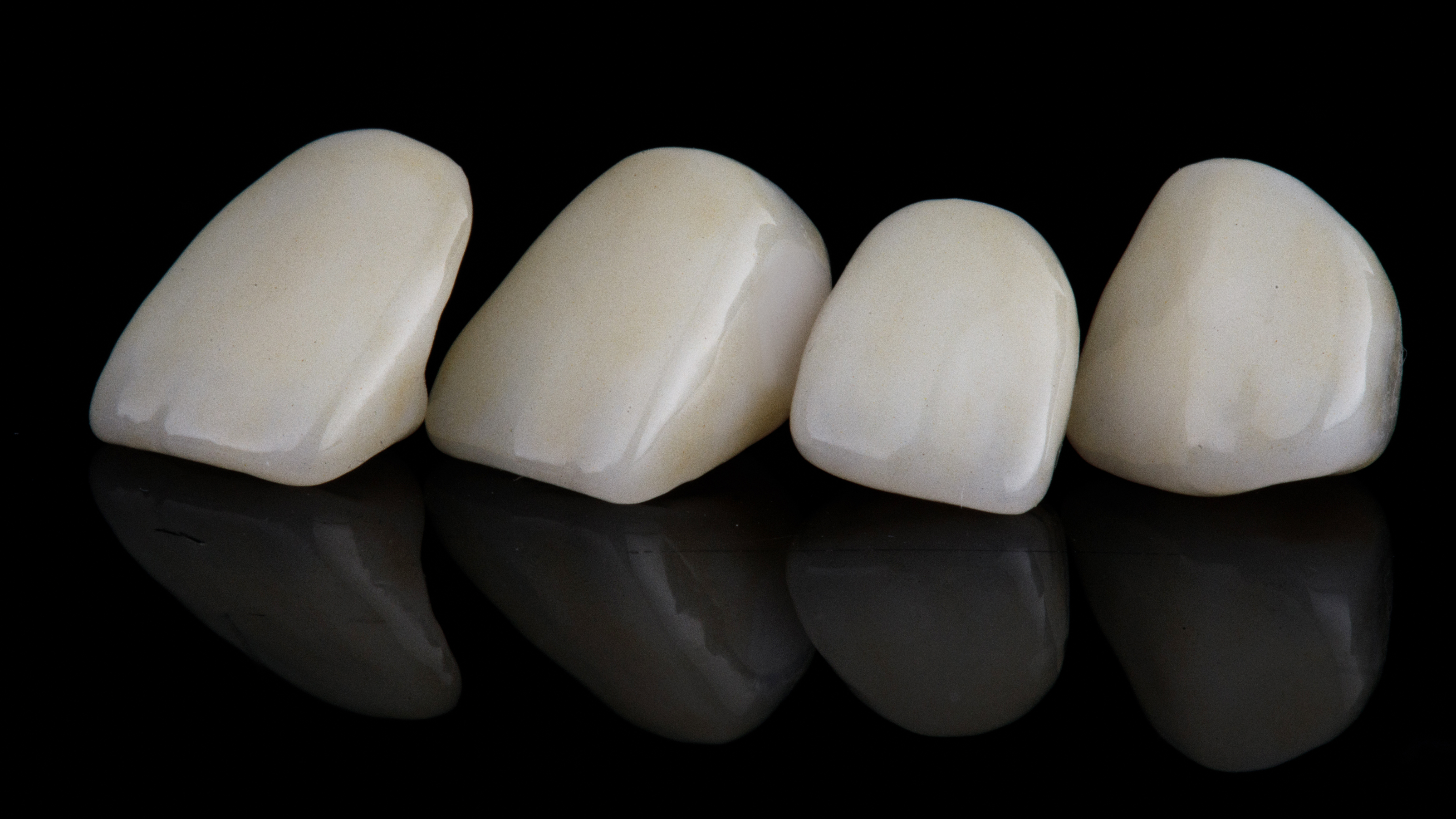 Placing Lifelike Crowns On Your Teeth | Livonia, MI